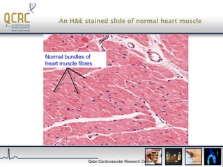 Histology of heart disease | PPT