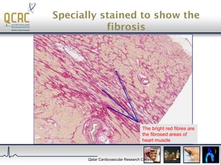 Histology of heart disease | PPT