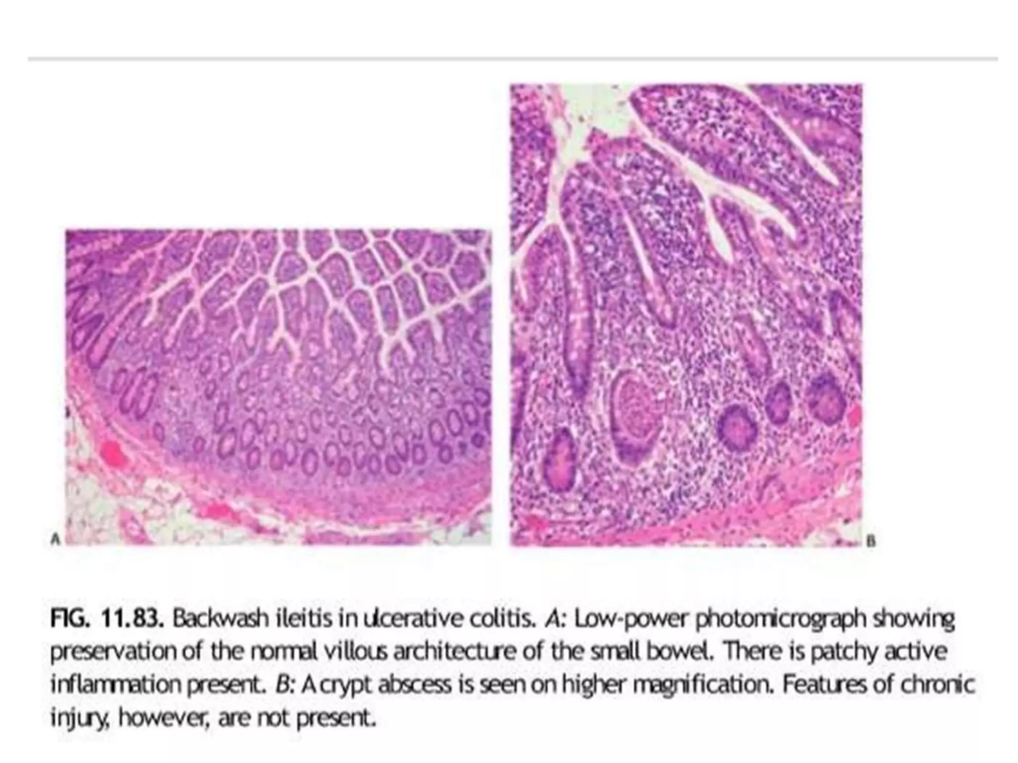 Histology of ibd | PPTX