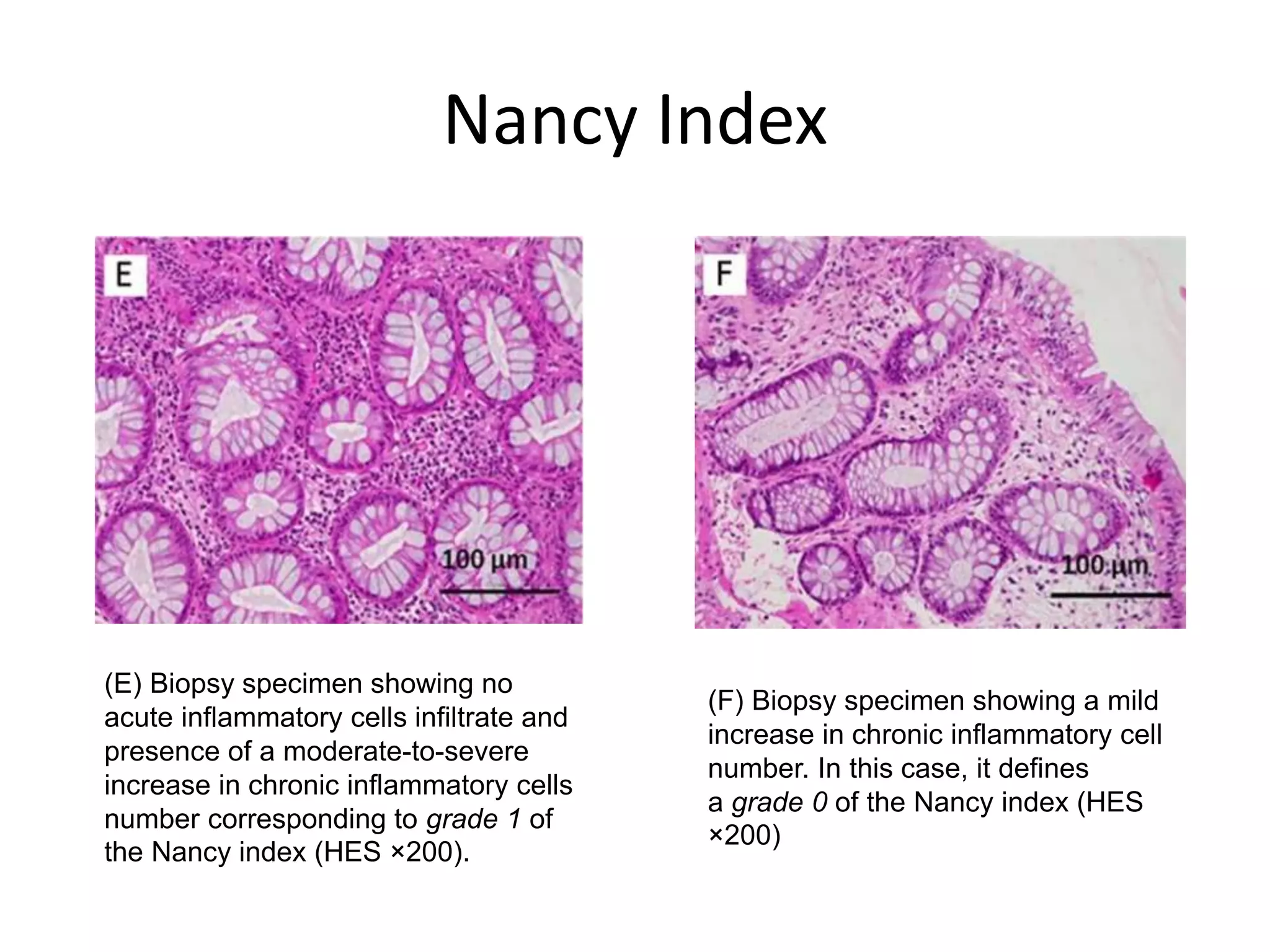 Histology of ibd | PPTX