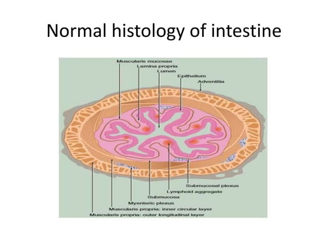 Histology of ibd | PPTX | Digestive Disorders | Diseases and Conditions