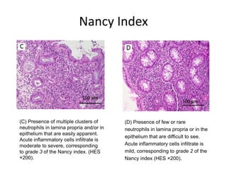 Histology of ibd | PPTX