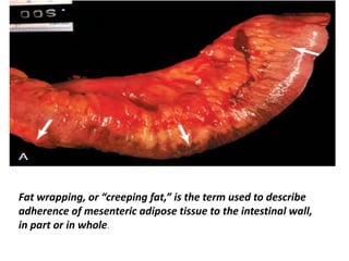 Histology of ibd | PPTX