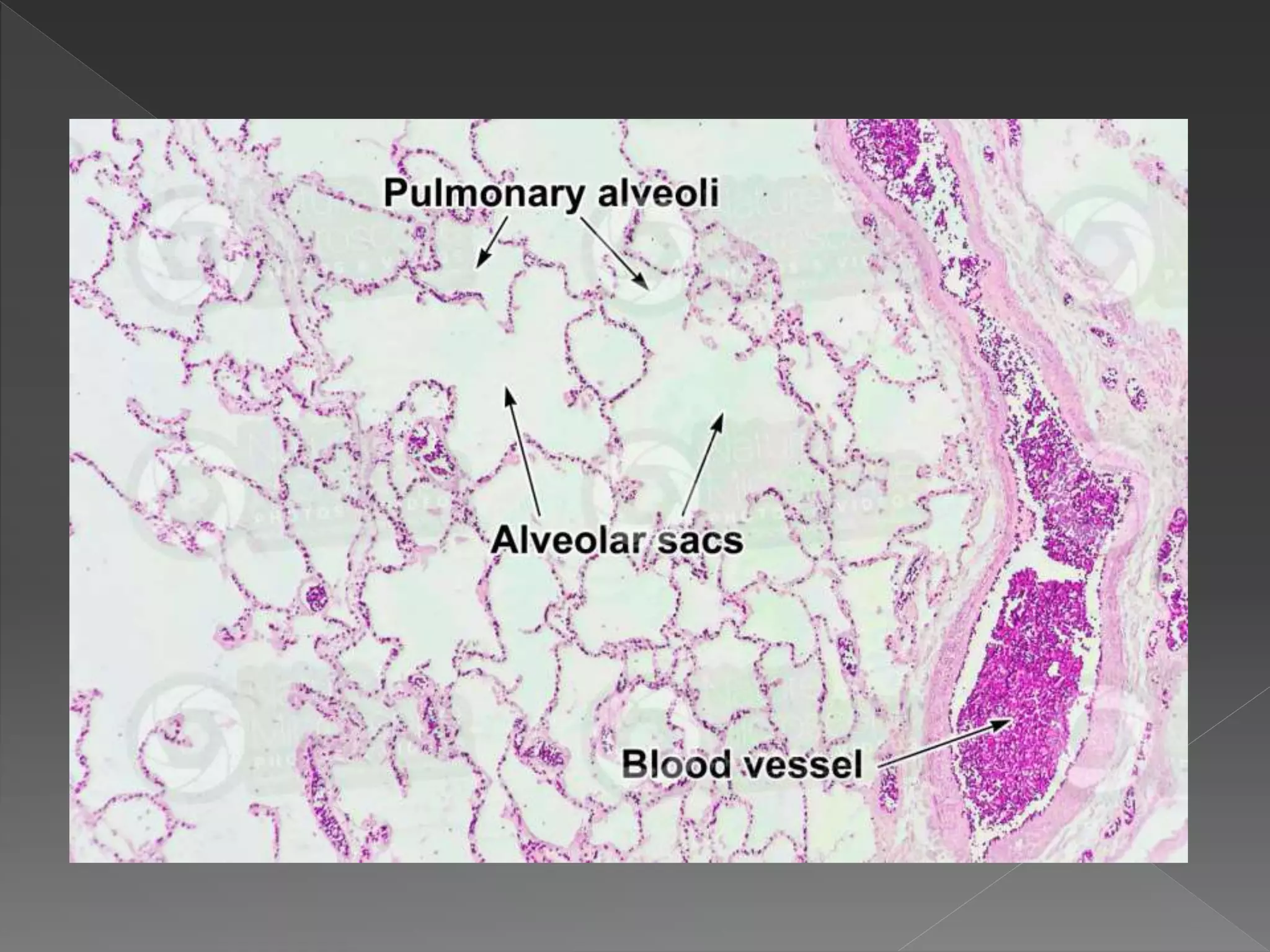 Alveoli Histology Labeled Alveolar Duct With Alveoli