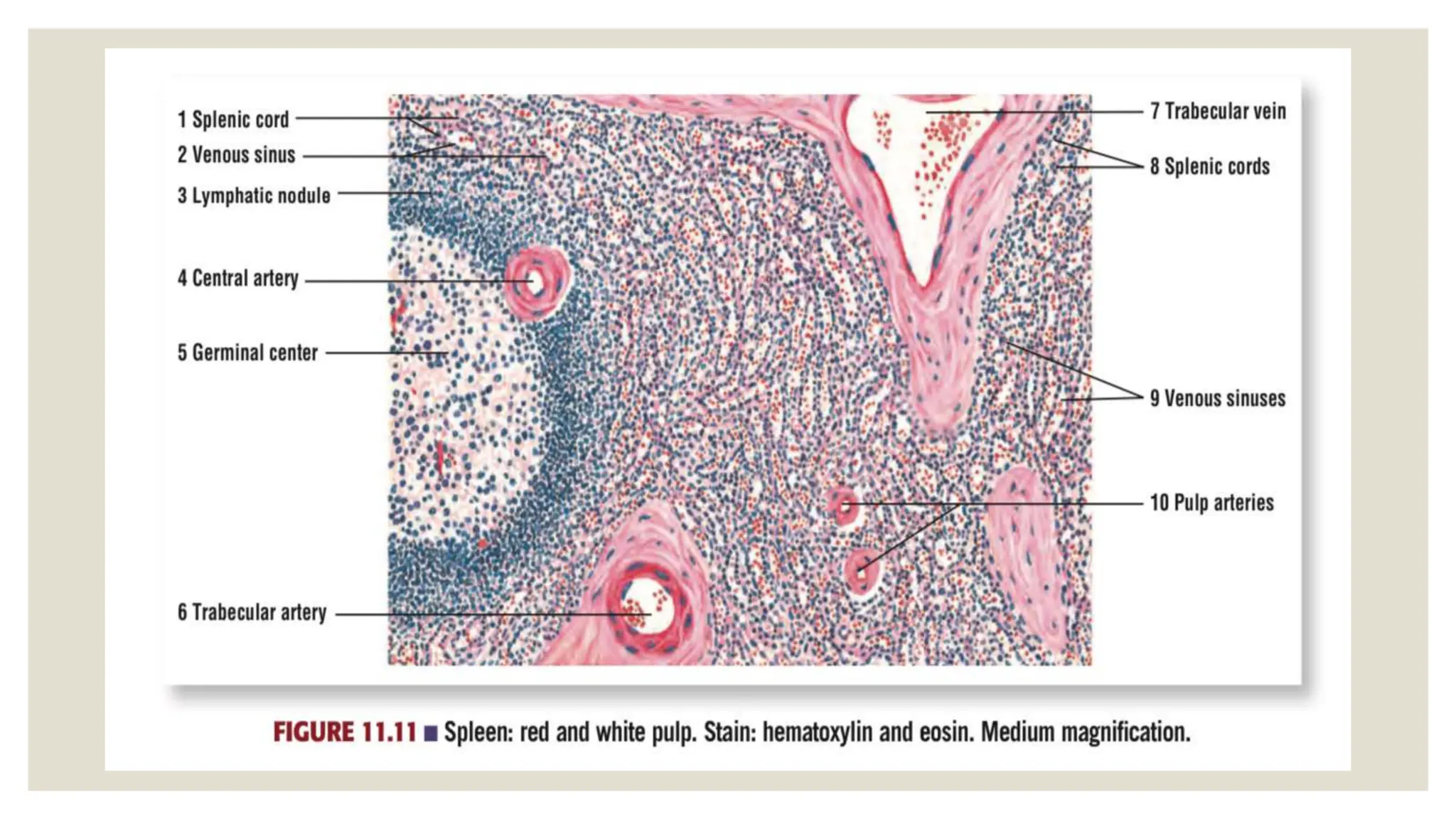 Lymph Node Slide Diagram