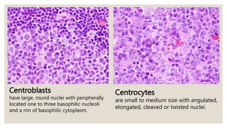 Histology of lymph node(lymph node histology) | PPTX