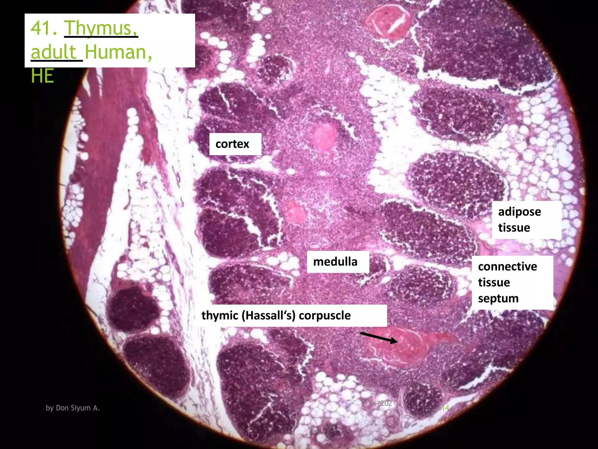 Histology of lymphatic system | PPTX