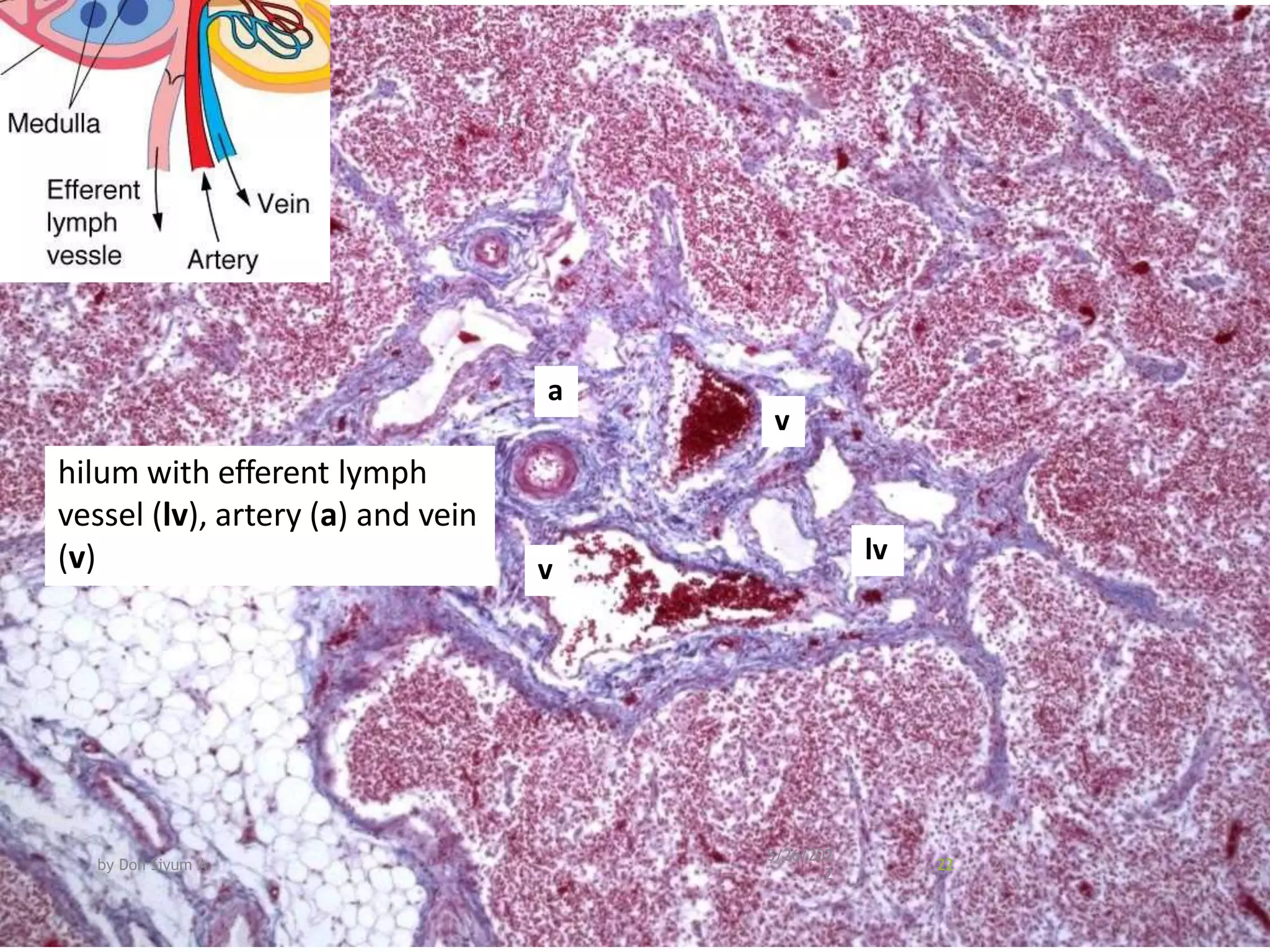 Histology of lymphatic system | PPTX