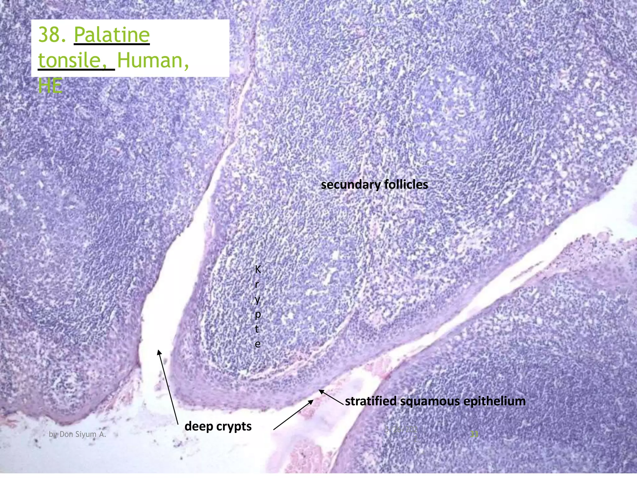 Histology of lymphatic system | PPTX