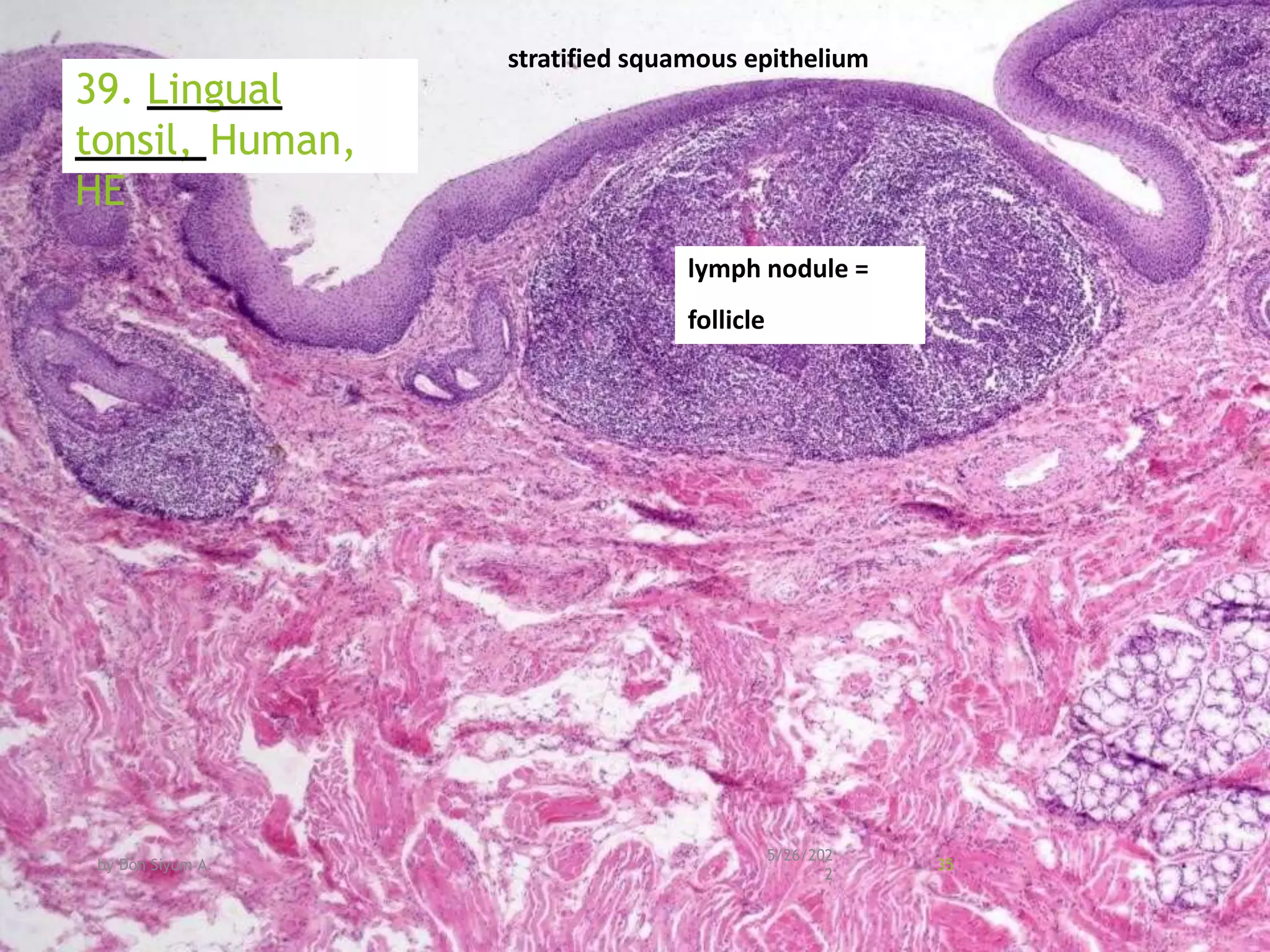 Histology of lymphatic system | PPTX