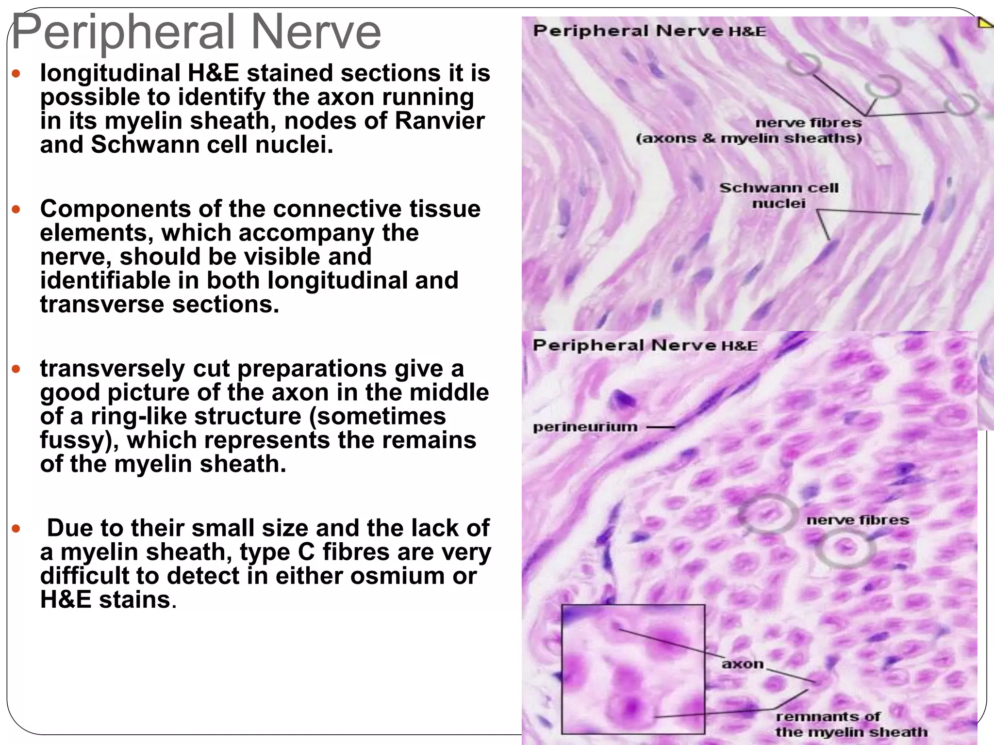 Histology of nerve system | PDF