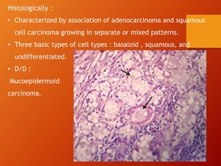 Verrucous Carcinoma Histology