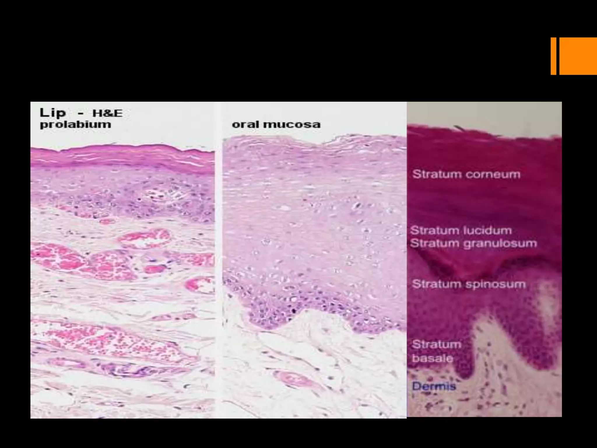 Histology of oral mucous membrane and gingiva | PPTX