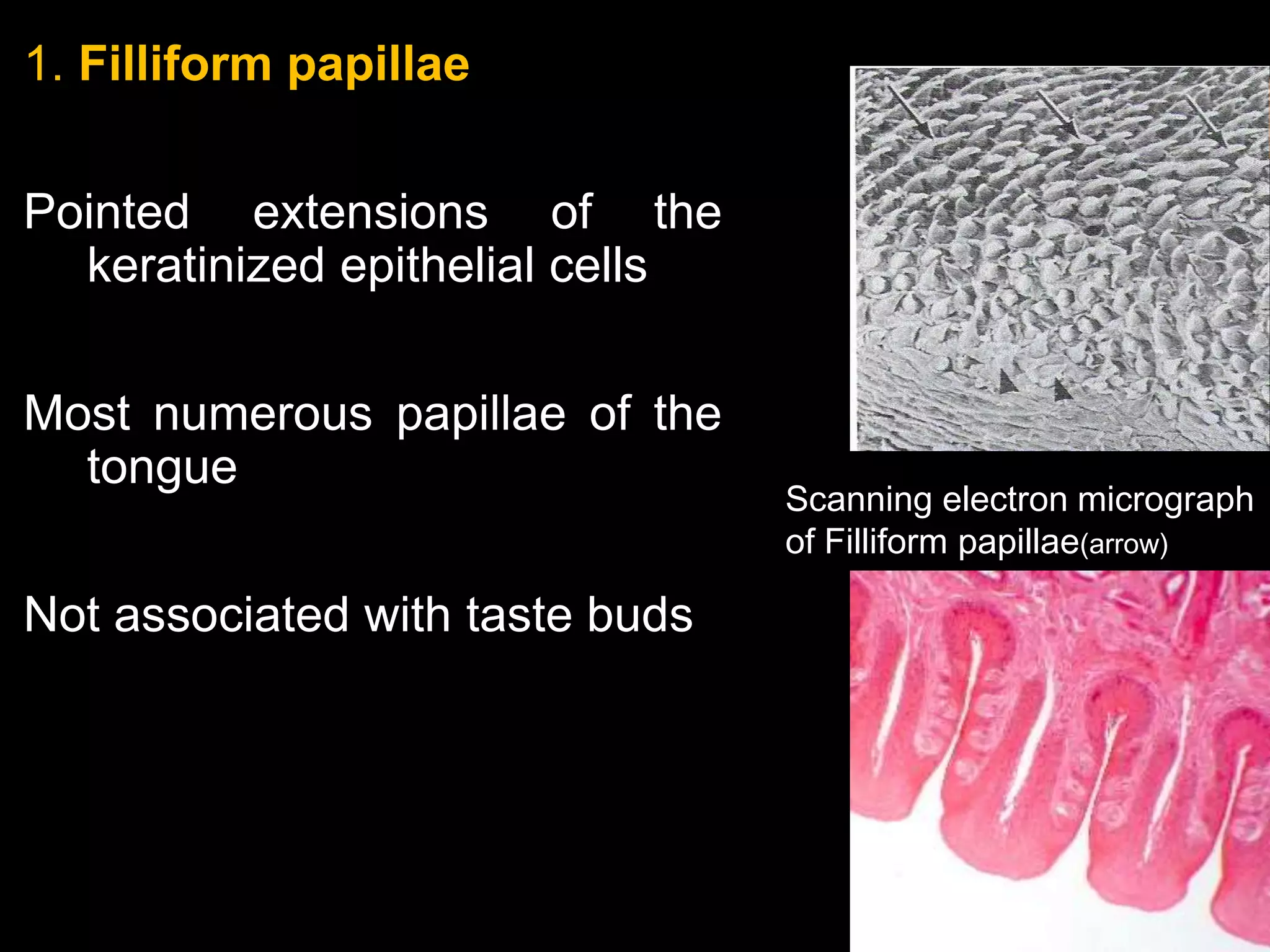 Histology of oral mucous membrane and gingiva | PPTX
