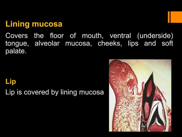 Histology of oral mucous membrane and gingiva | PPTX | Dental Health ...
