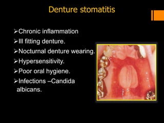Histology of oral mucous membrane and gingiva | PPTX