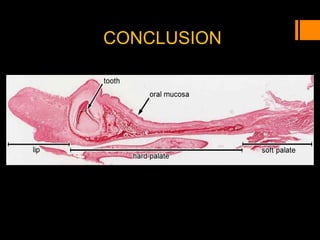 Smokers Palate Histology
