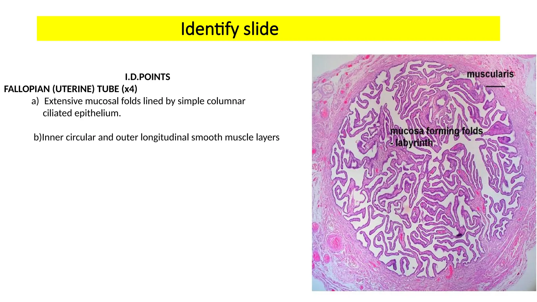 Histology of Ovaries, Uterine tubes, Uterus, Vagina..pptx