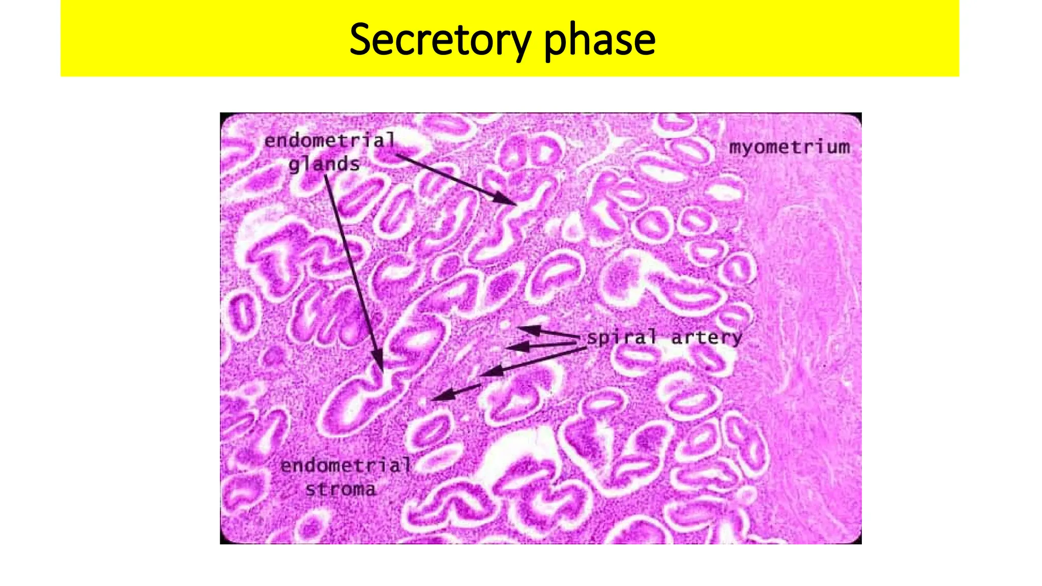 Histology of Ovaries, Uterine tubes, Uterus, Vagina..pptx