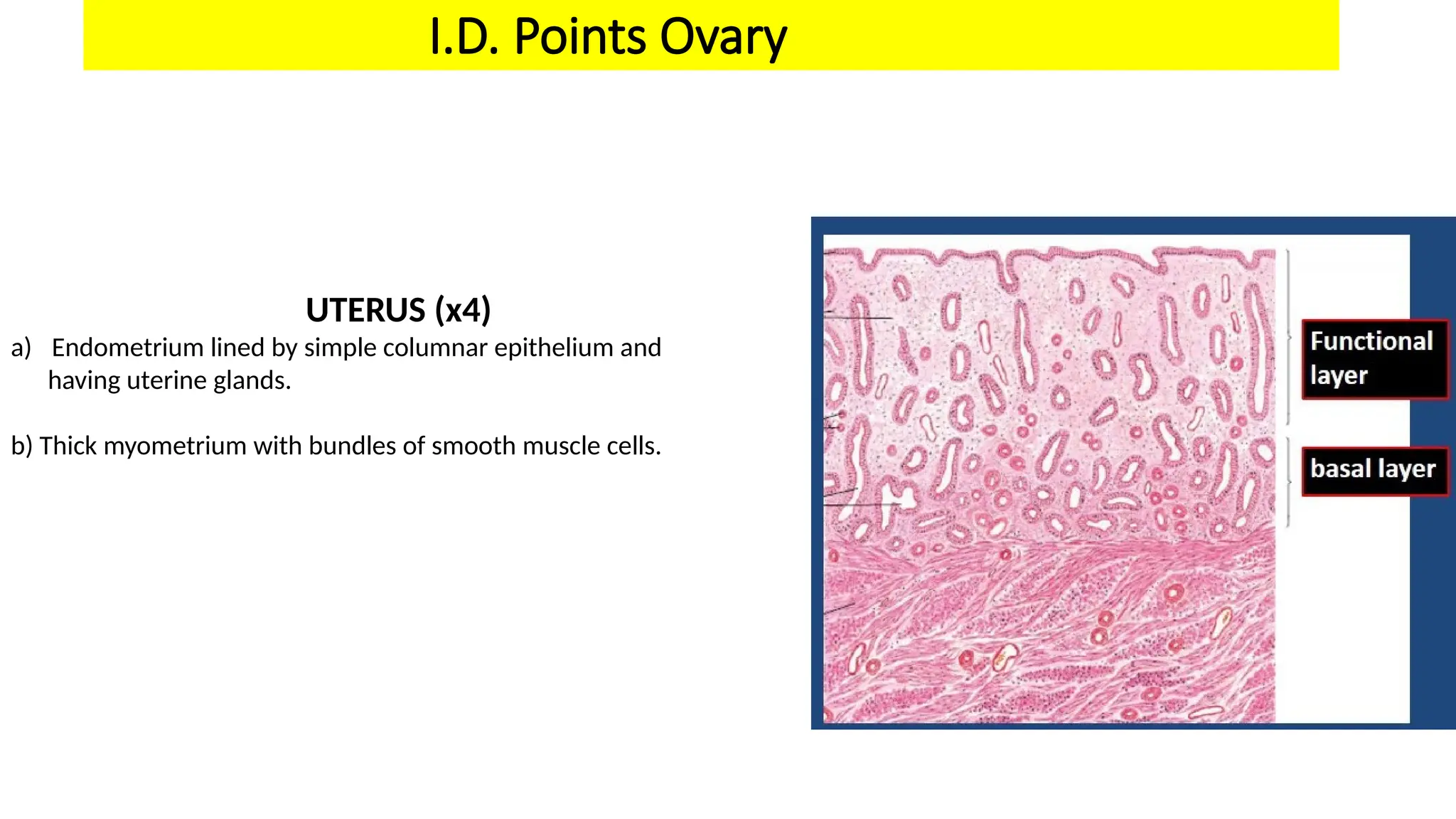 Histology of Ovaries, Uterine tubes, Uterus, Vagina..pptx