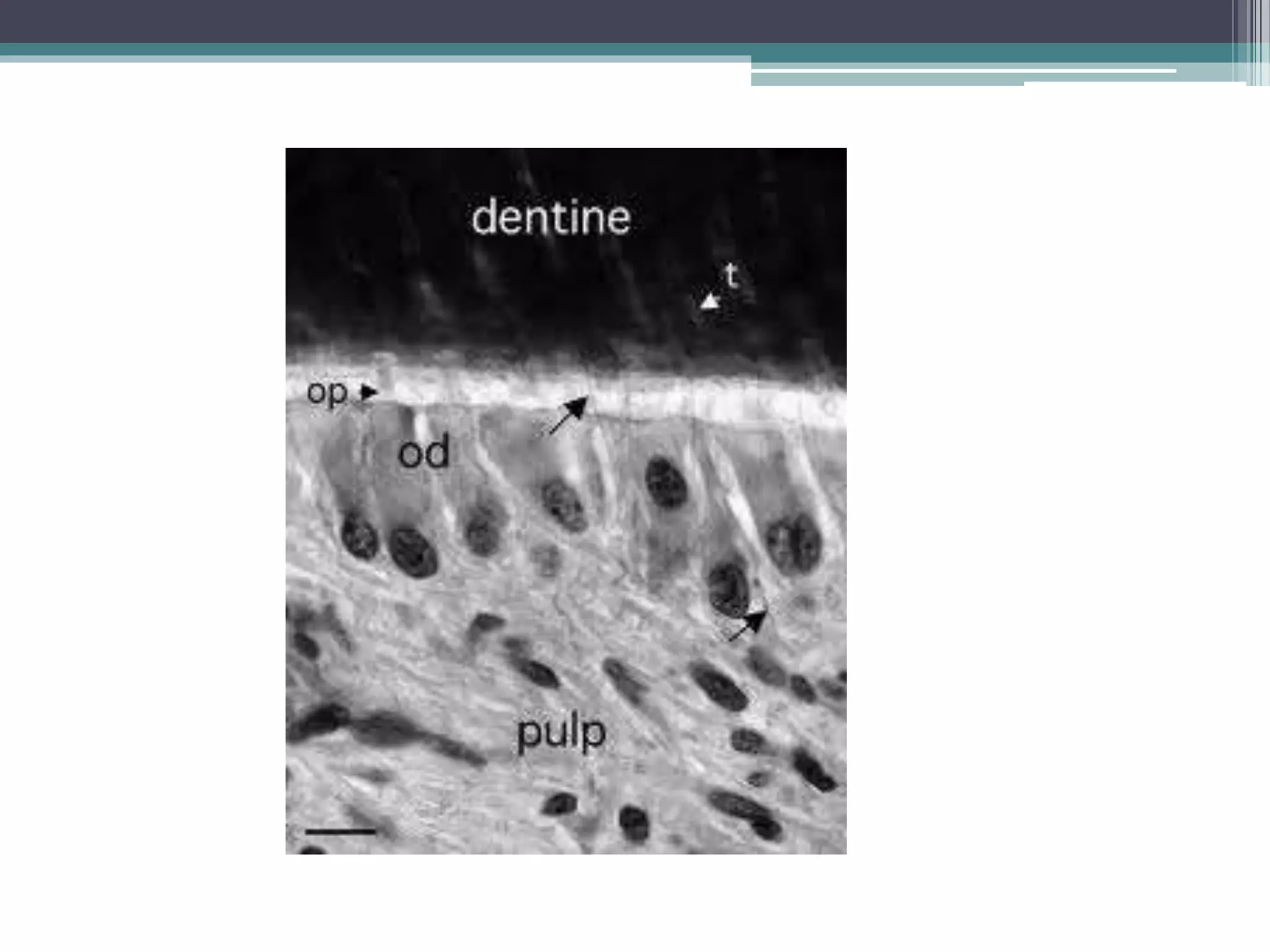 Histology of Pulp | PPTX | Dental Health | Diseases and Conditions