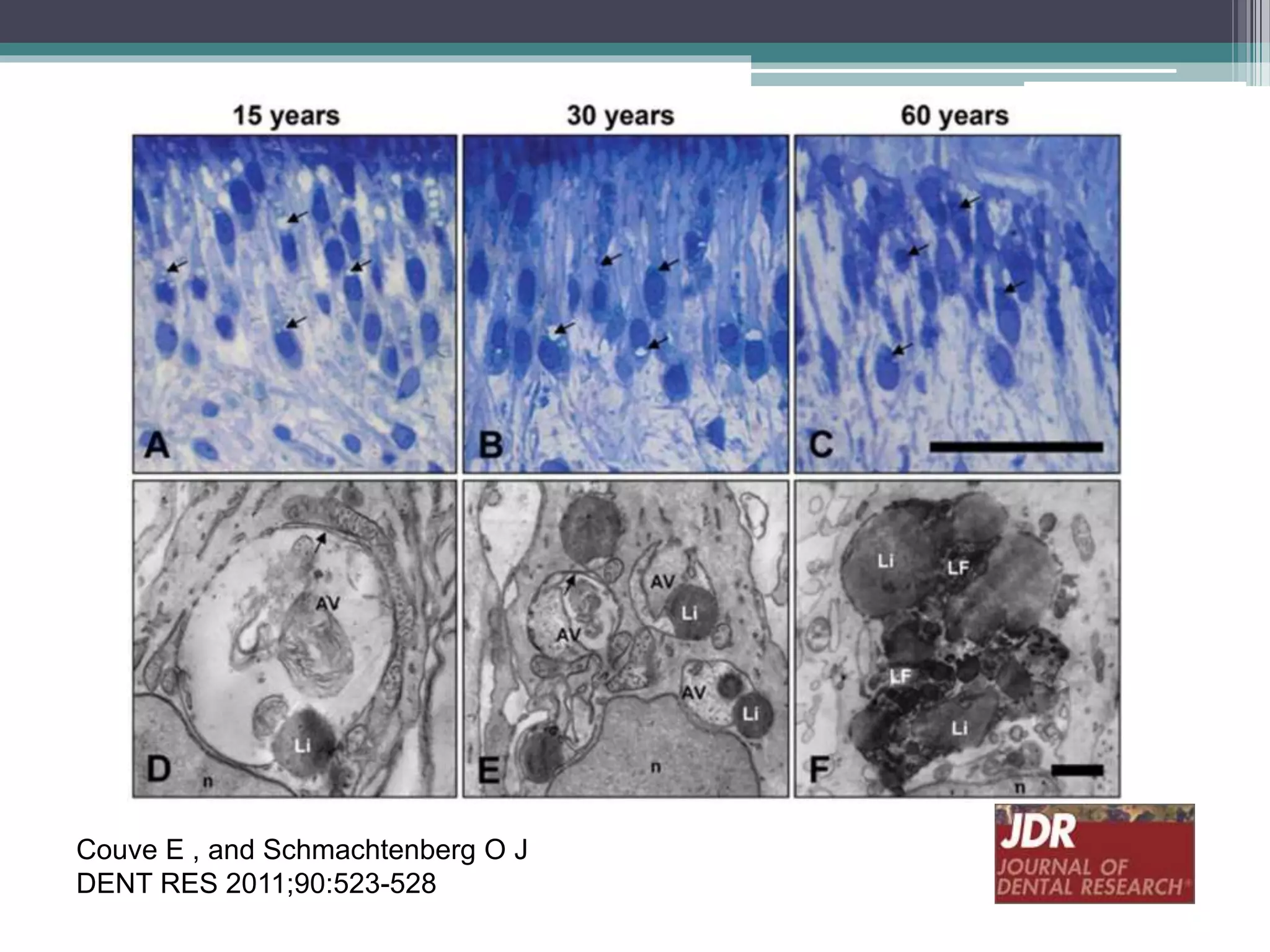 Histology of Pulp | PPTX | Dental Health | Diseases and Conditions