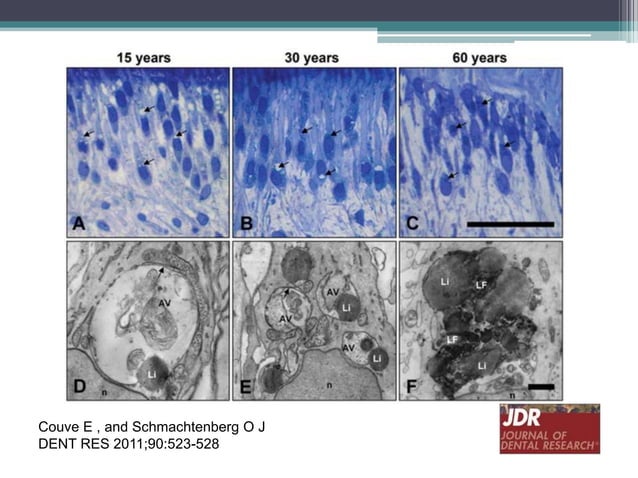 Histology of Pulp | PPTX | Dental Health | Diseases and Conditions