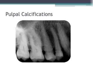 Histology of Pulp | PPTX