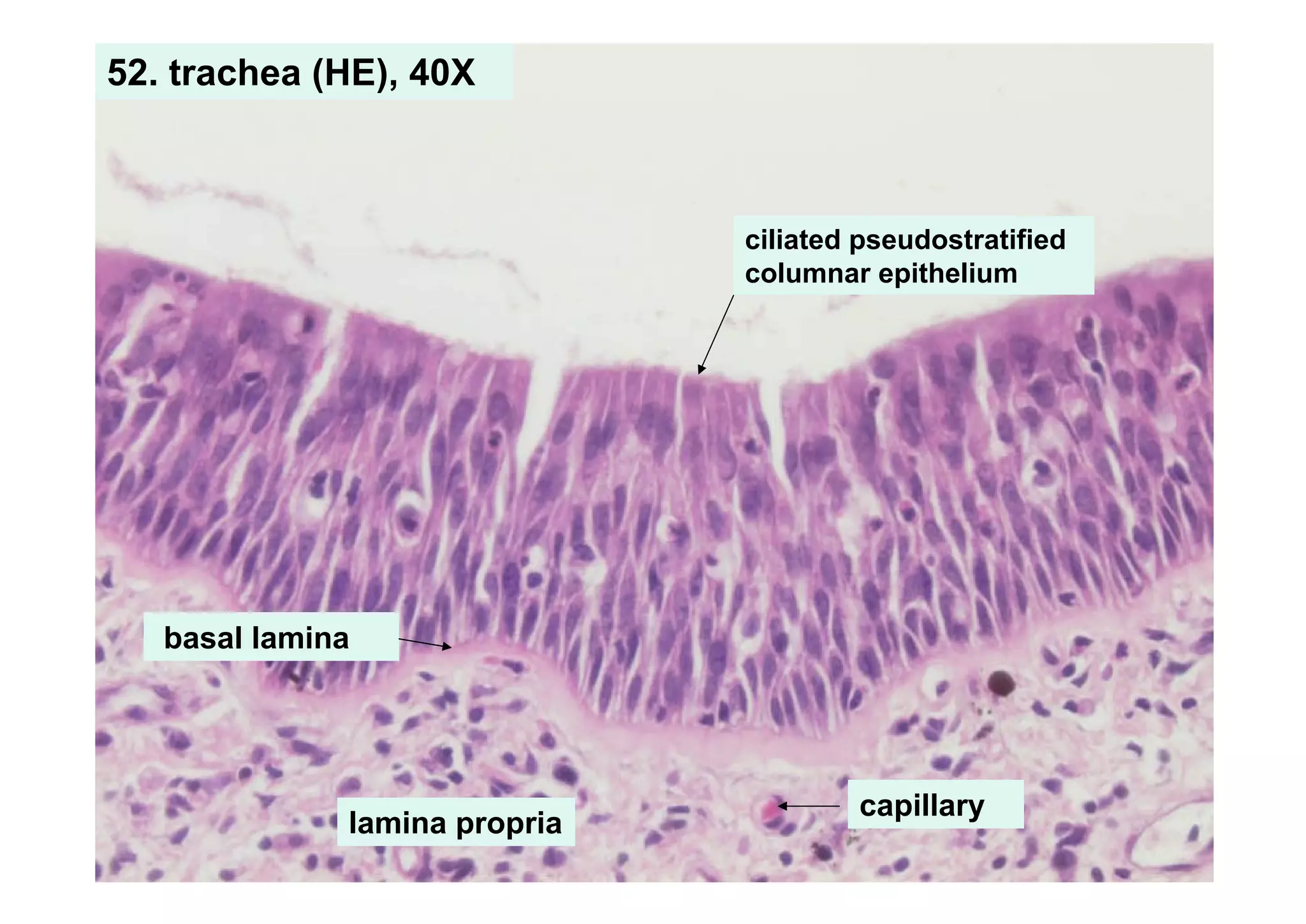 Histology of respiratory system larynx trache and lung | PDF