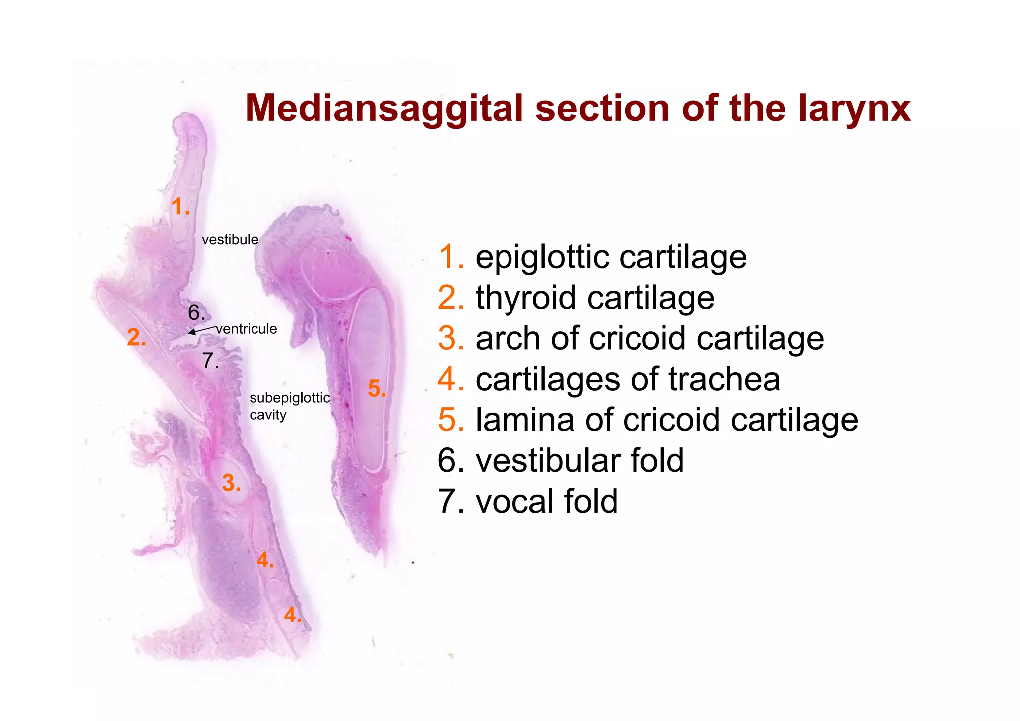 Larynx Histology Slide Labeled