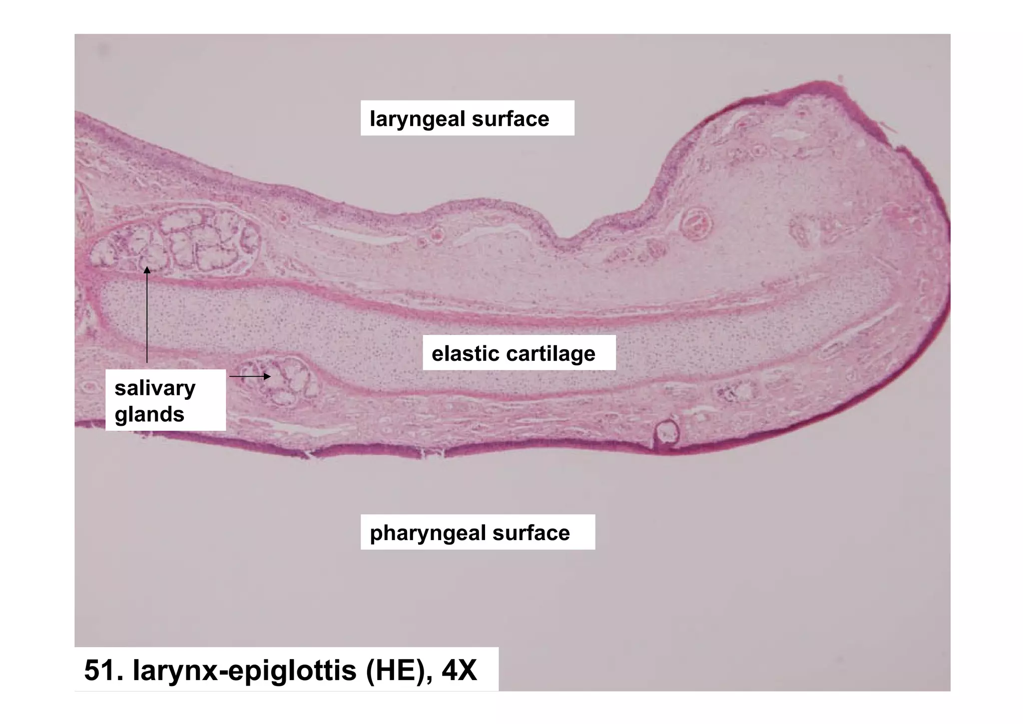 Histology of respiratory system larynx trache and lung | PDF