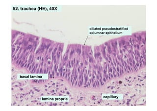 Larynx Histology Slide