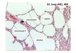 Bronchus Slide Labelled