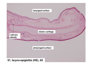 Epiglottis Histology Labeled