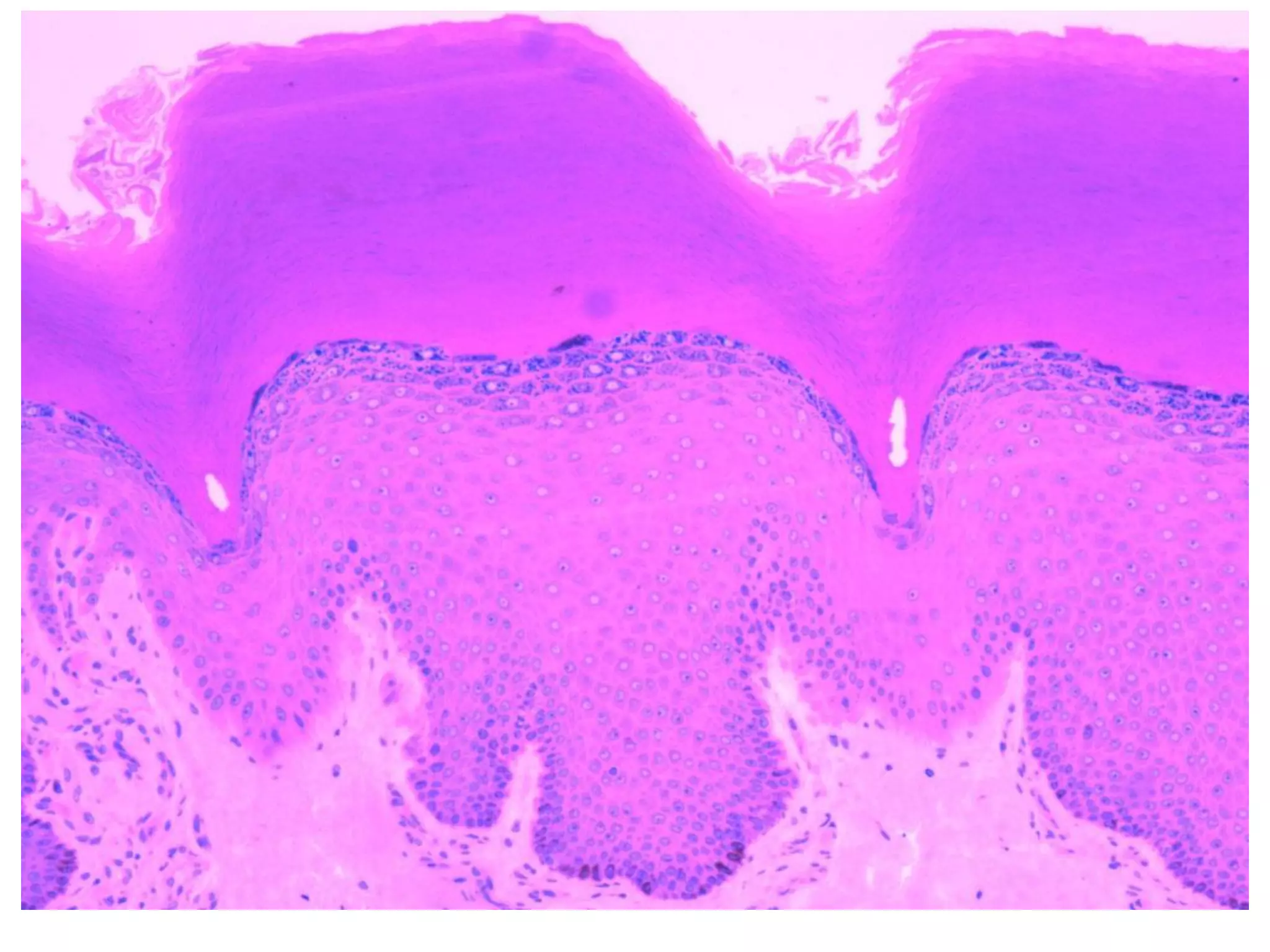 Histology of skin | PDF