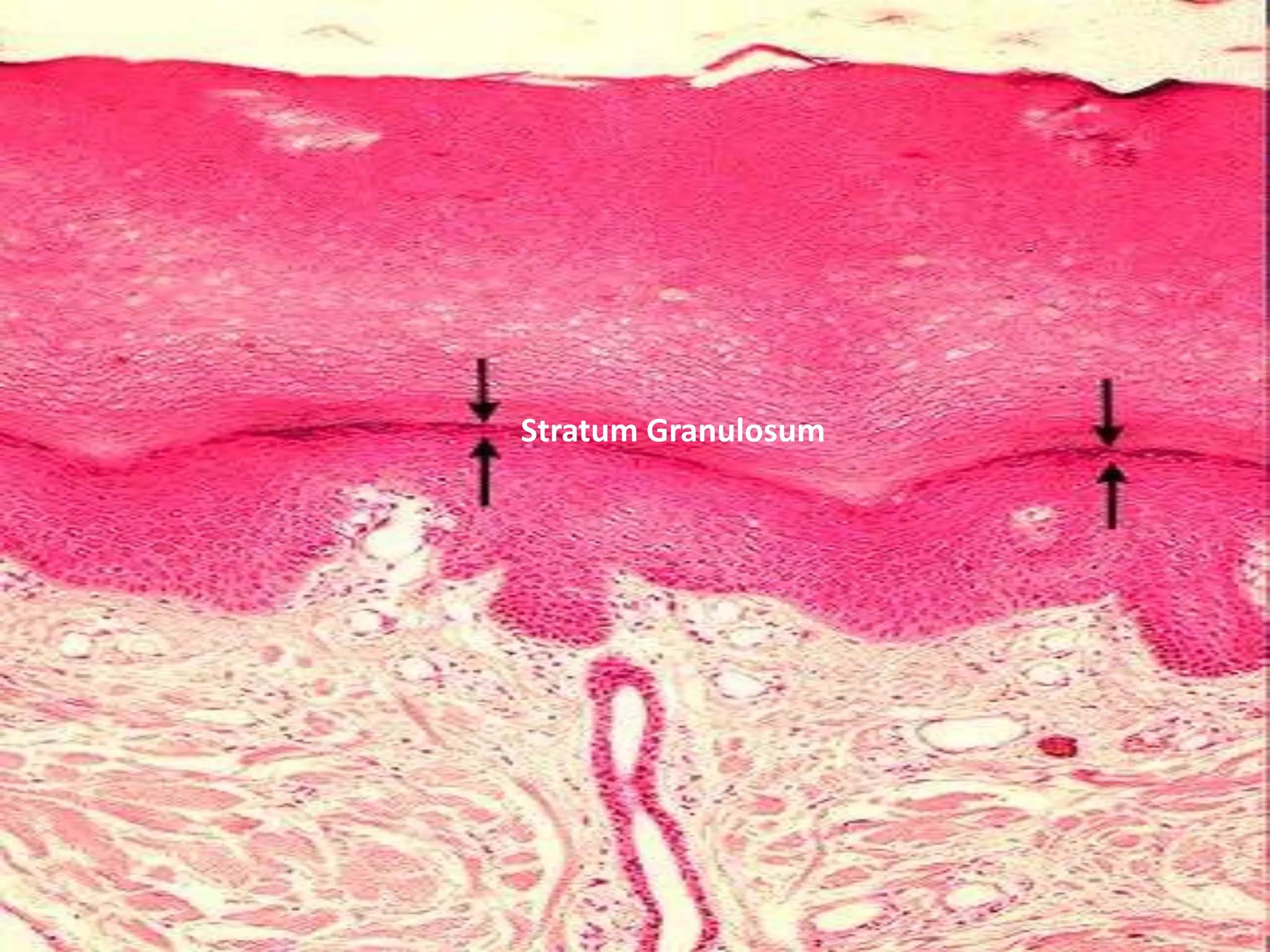 Anatomy and Histology of Skin(Dermis & Epidermis).pptx