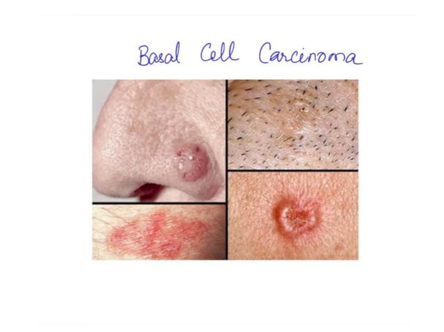 Anatomy and Histology of Skin(Dermis & Epidermis).pptx | Skin and Dermatology | Diseases and ...