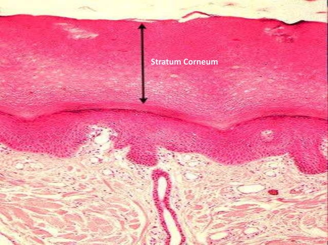 Anatomy and Histology of Skin(Dermis & Epidermis).pptx | Skin and ...