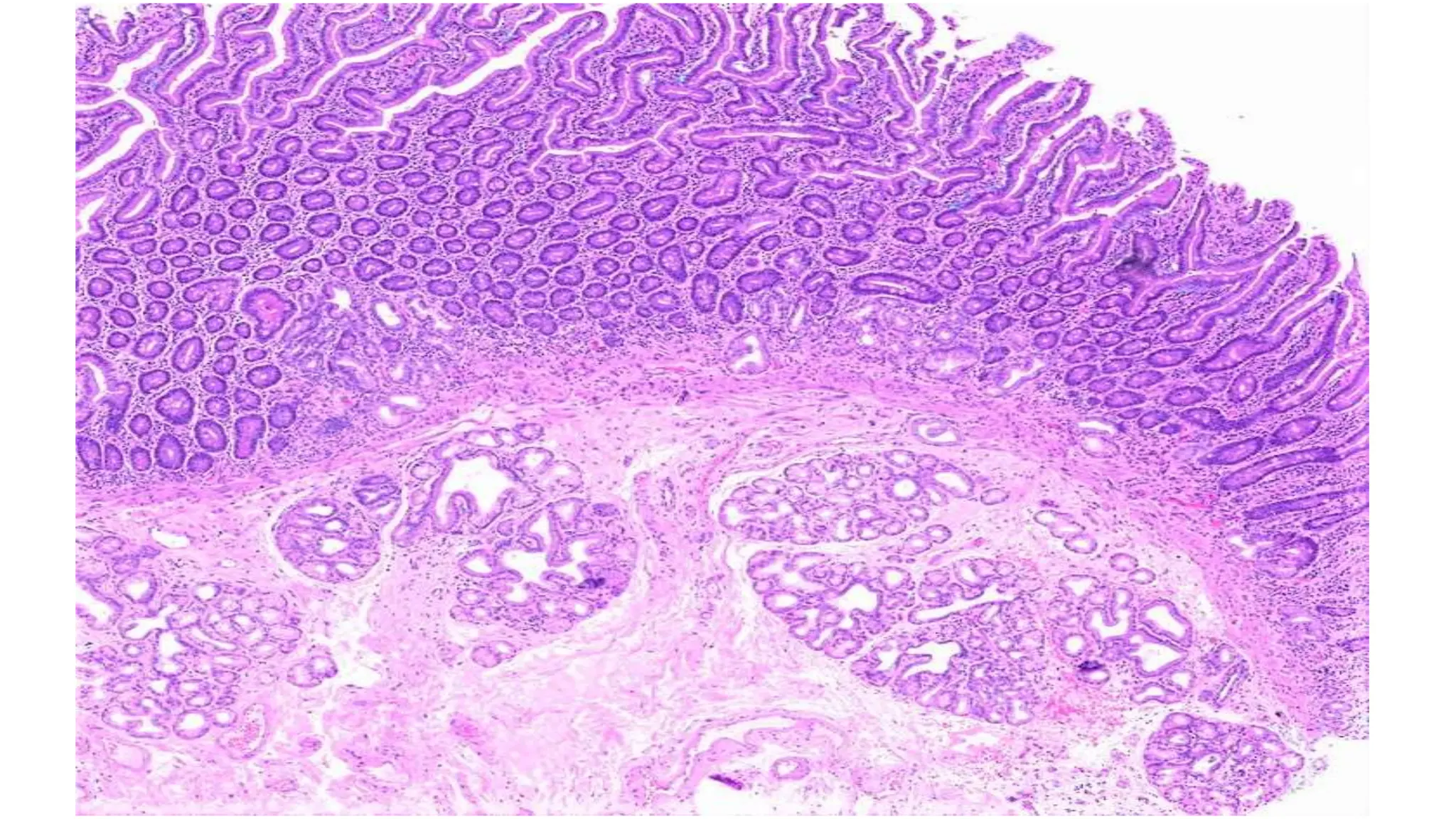 Histology/Micro Anatomy of Small Intestine.pptx