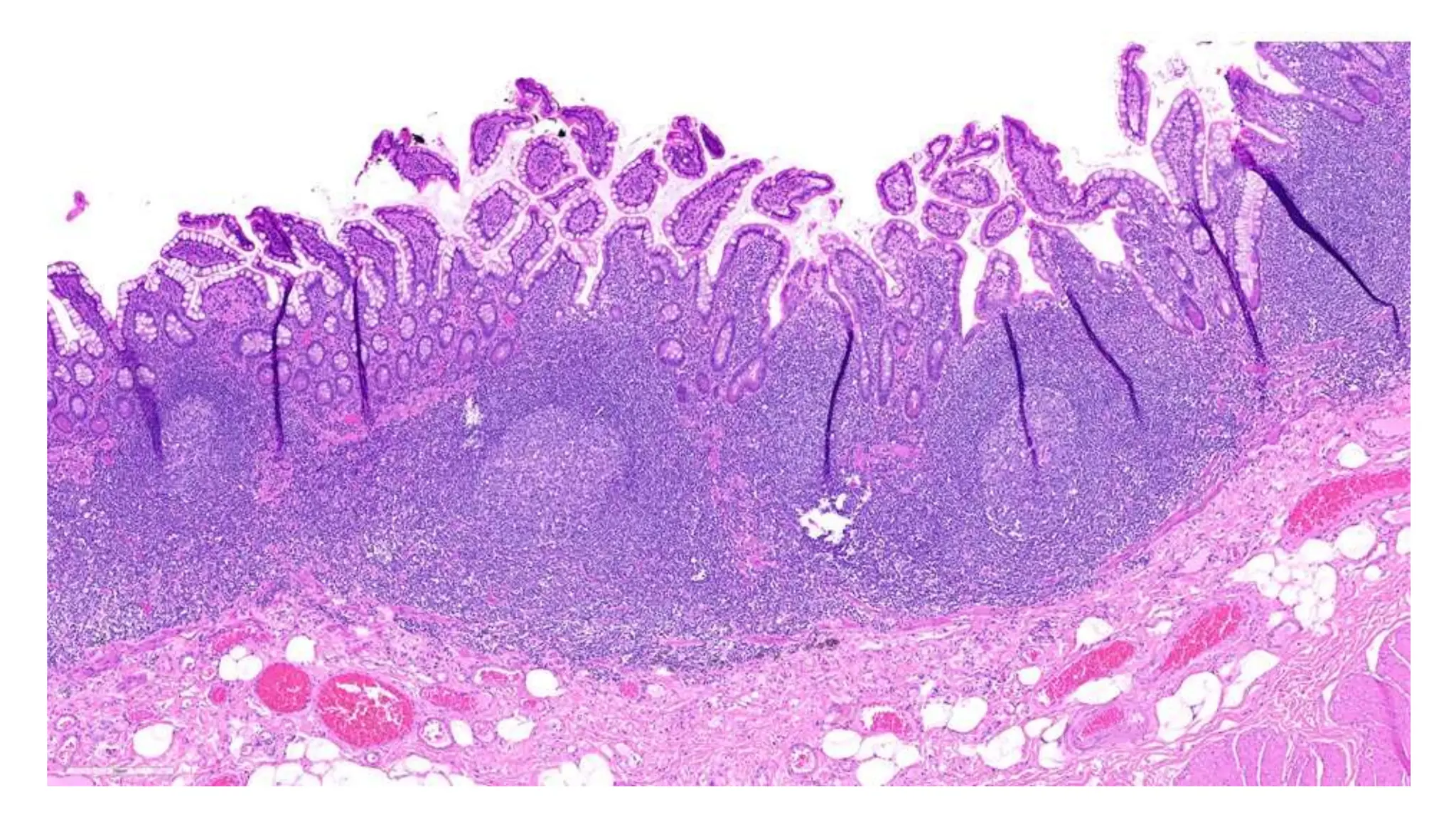 Histology/Micro Anatomy of Small Intestine.pptx
