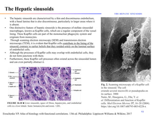 Histology of the liver - Maha Hammady.pptx