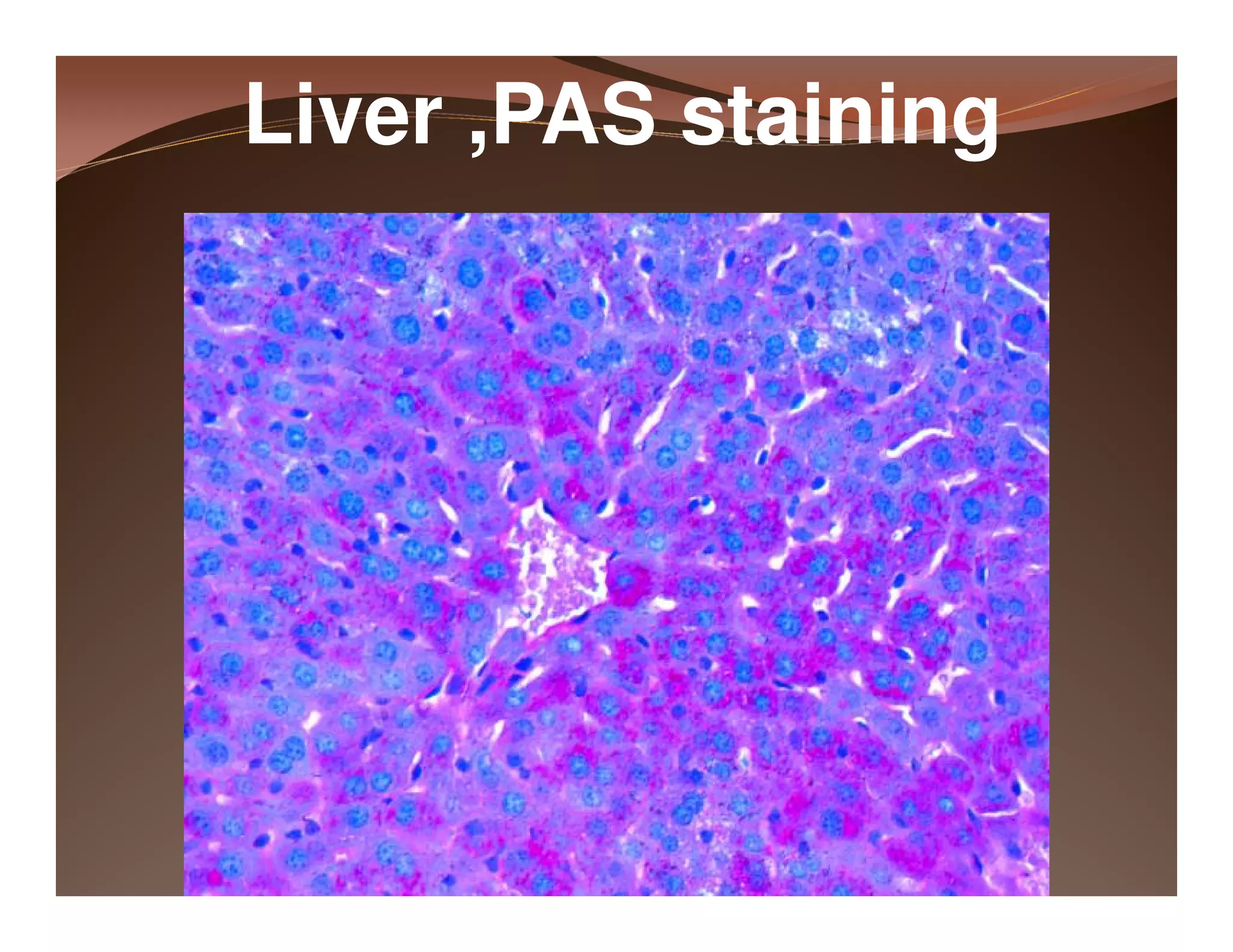 Histology of the liver and gall bladder [compatibility mode] | PDF