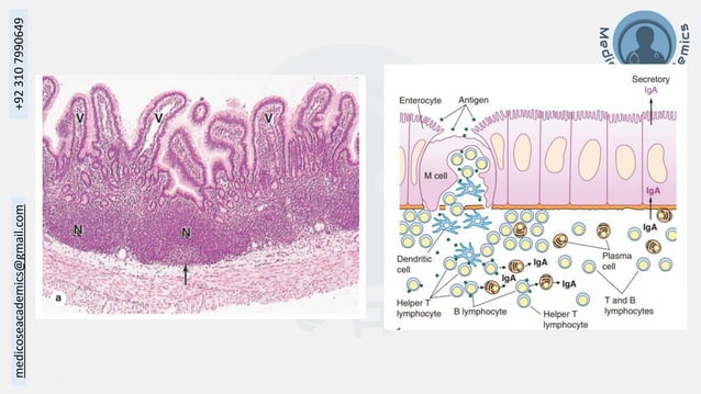 Histology of the Lymphoid Organs - Dr Muhammad Ali Rabbani | PDF ...