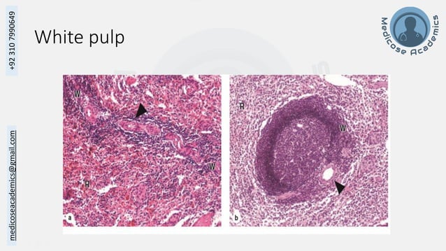 Histology of the Lymphoid Organs - Dr Muhammad Ali Rabbani | PDF ...