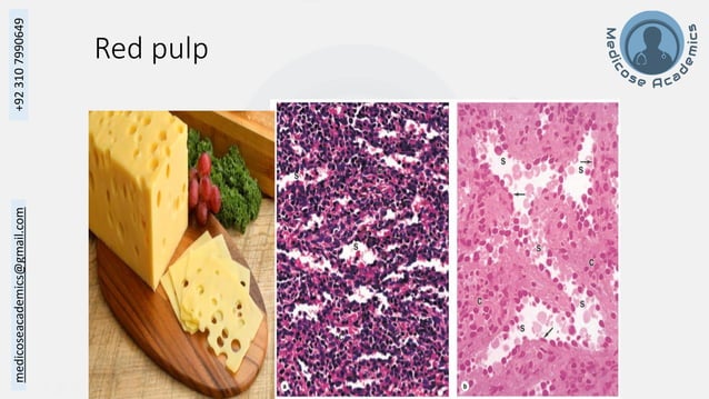 Histology of the Lymphoid Organs - Dr Muhammad Ali Rabbani | PDF ...