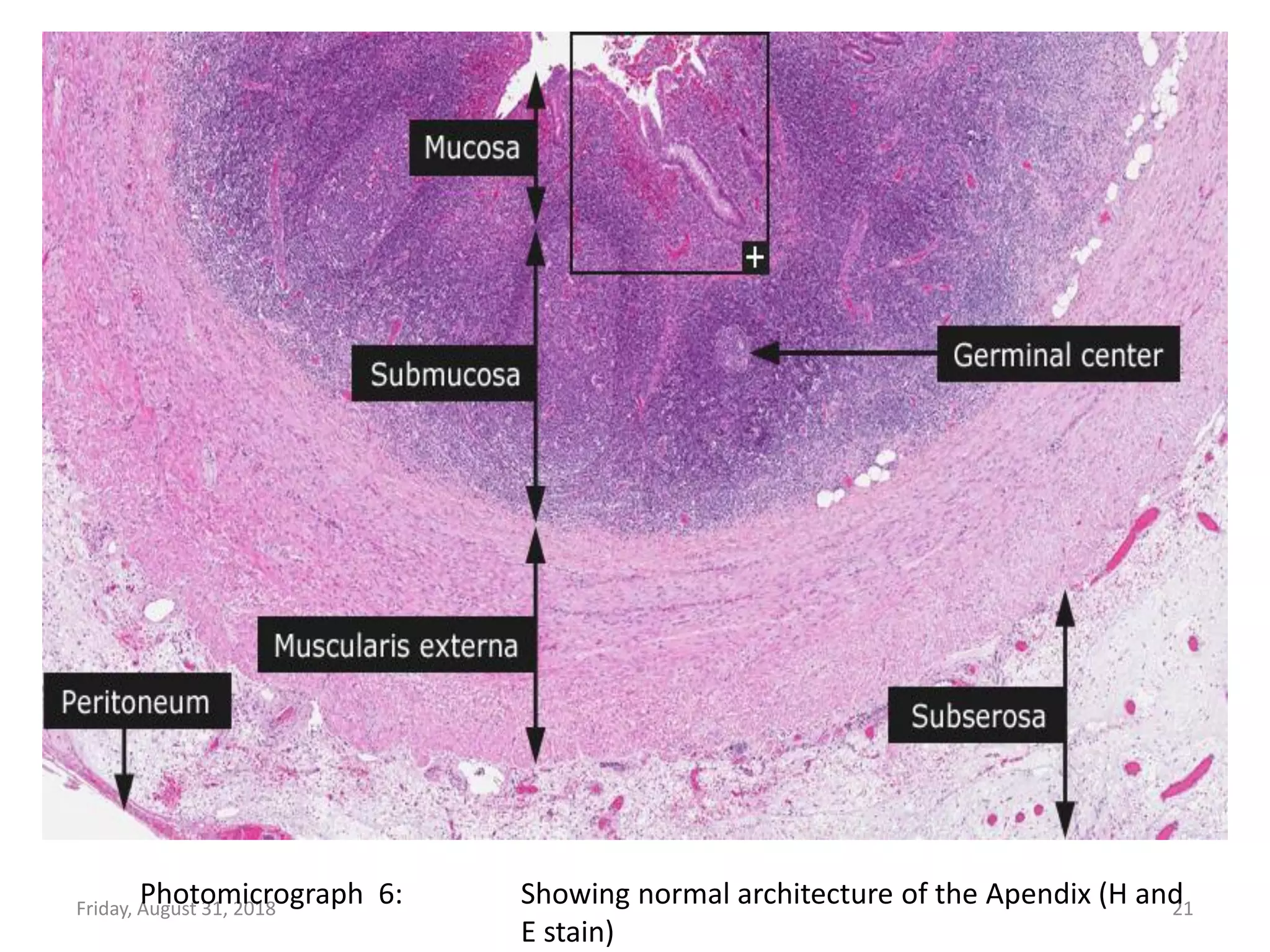Histology of the pancreas, gall bladder and appendix by Zachariah ...