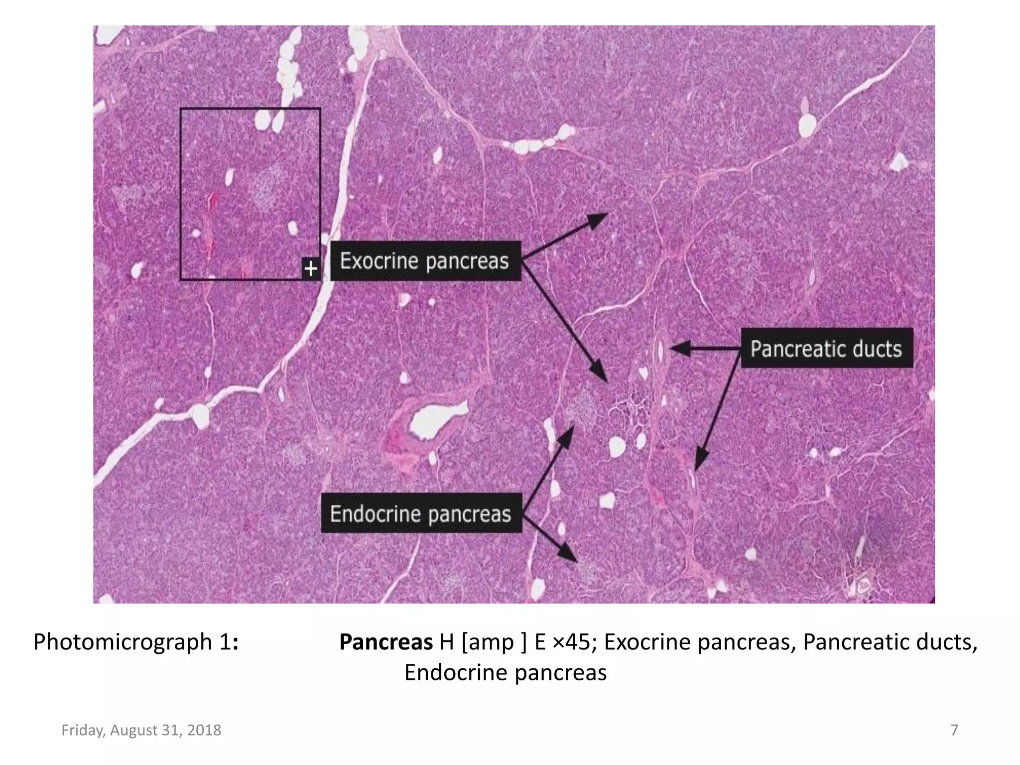 Histology of the pancreas, gall bladder and appendix by Zachariah ...