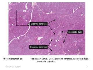 Histology of the pancreas, gall bladder and appendix by Zachariah ...