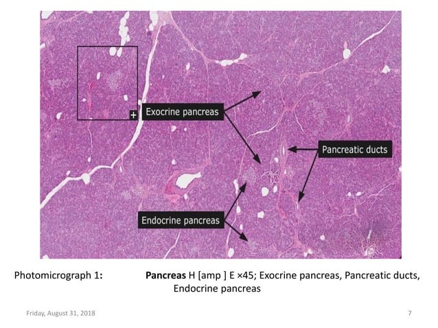 Histology of the pancreas, gall bladder and appendix by Zachariah ...
