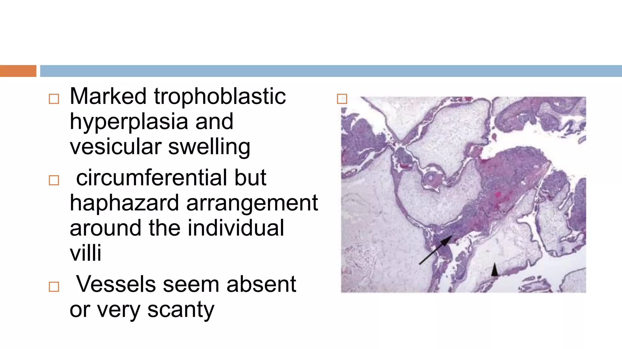 Histology of the Placenta.pptx